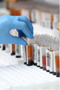Whole Blood Testing vs. Plasma or Serum – Rheovector